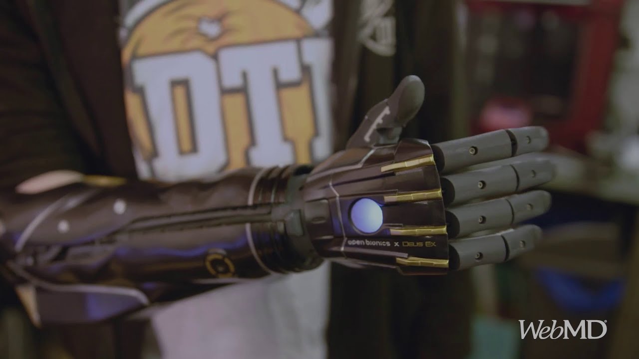 Hero Arm Bionic Prosthetic | WebMD - YouTube
