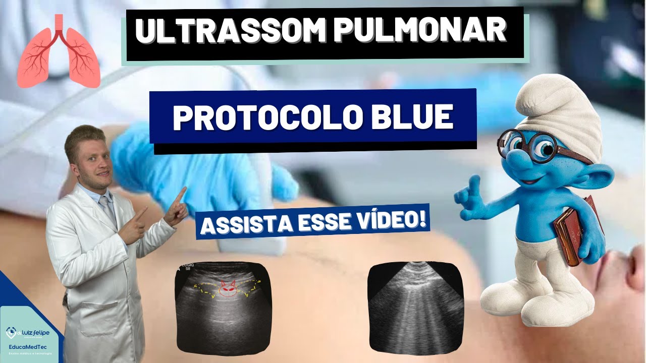 Ultrassom Pulmonar na Insuficiência Respiratória Aguda | Protocolo BLUE ...