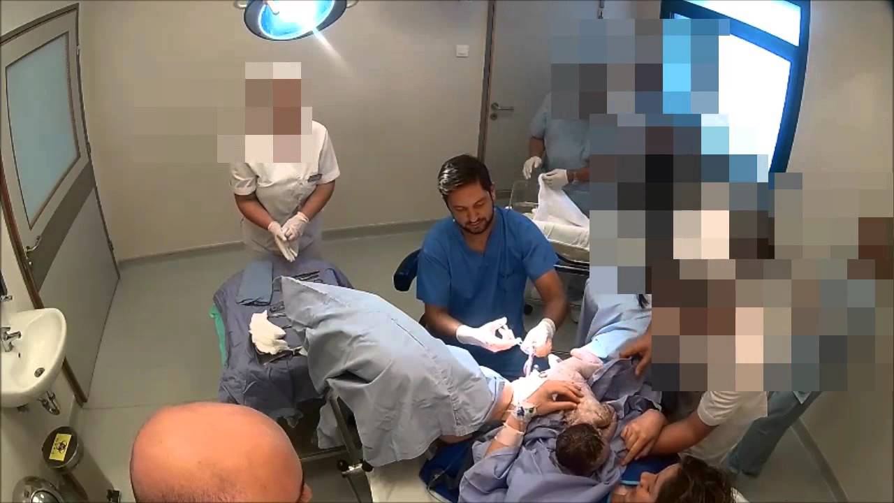 Φυσιολογικός Τοκετός με επισκληρίδιο αναλγησία - YouTube