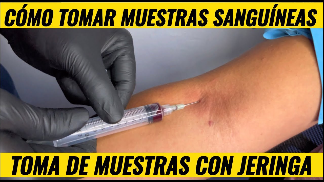 Como tomar muestras de sangre con jeringa - YouTube
