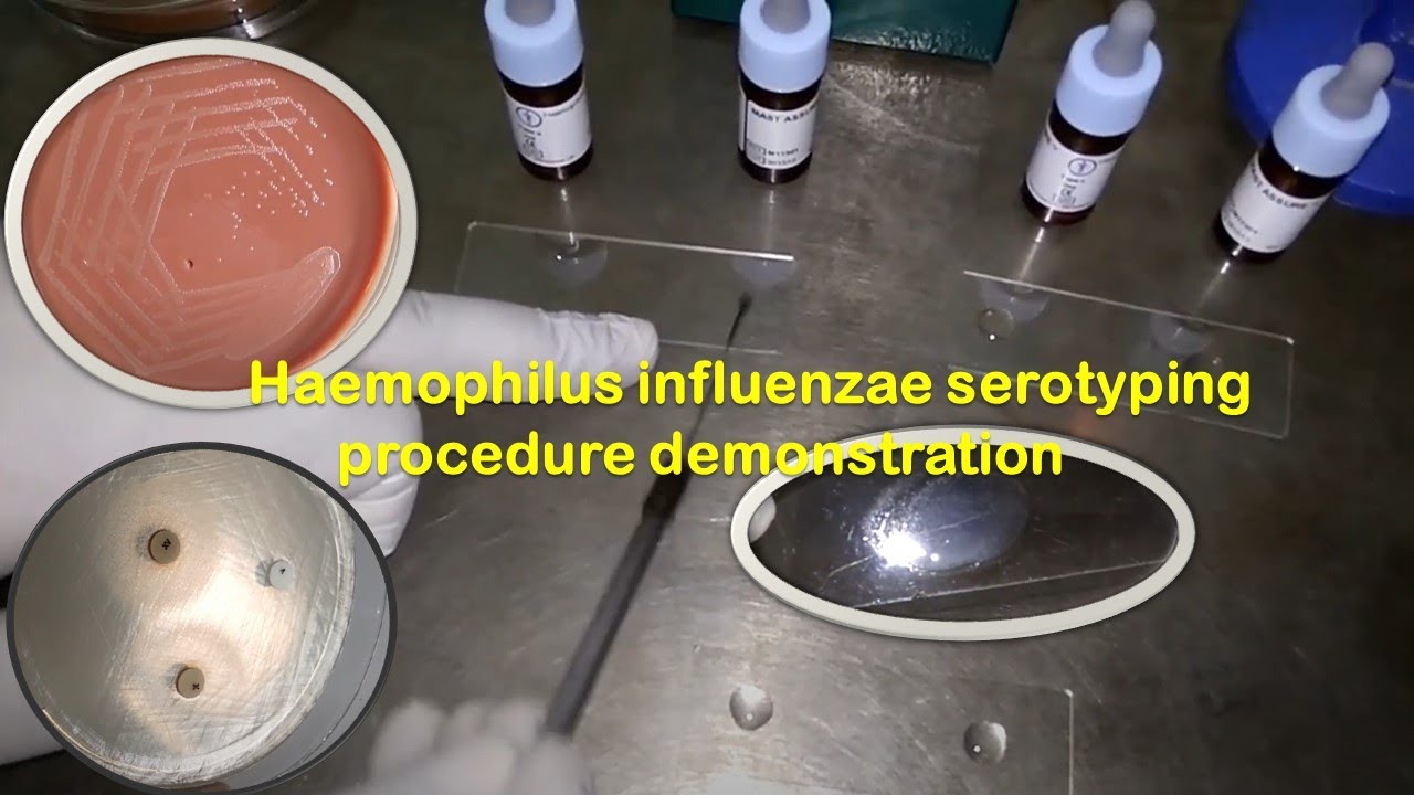 Haemophilus influenzae serotyping procedure demonstration - YouTube