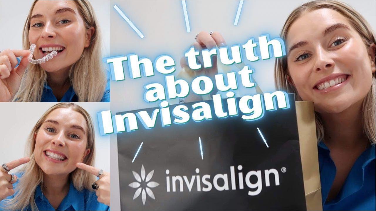 THE TRUTH ABOUT INVISALIGN!!! | Does it hurt? Is it worth it? How much ...