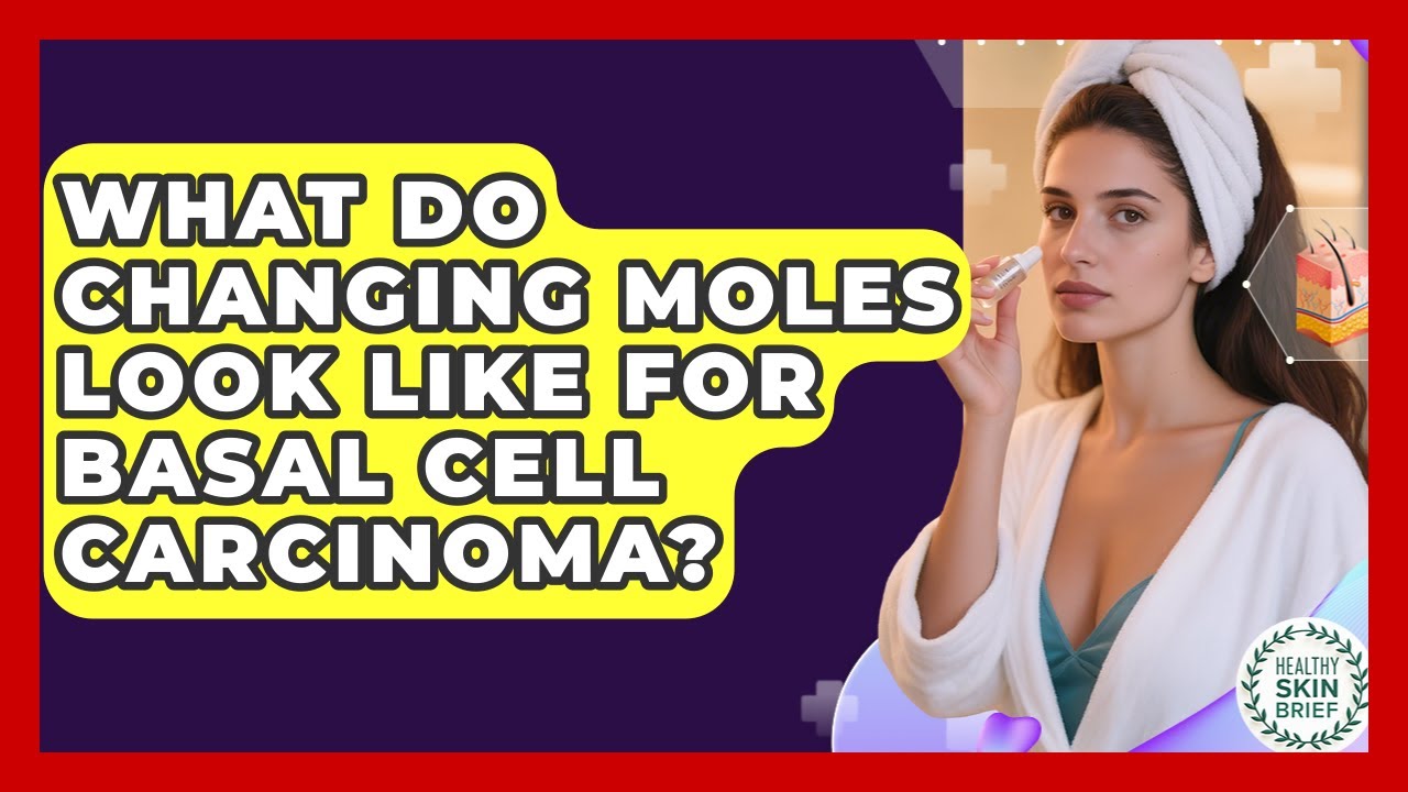 What Do Changing Moles Look Like For Basal Cell Carcinoma? - Healthy ...