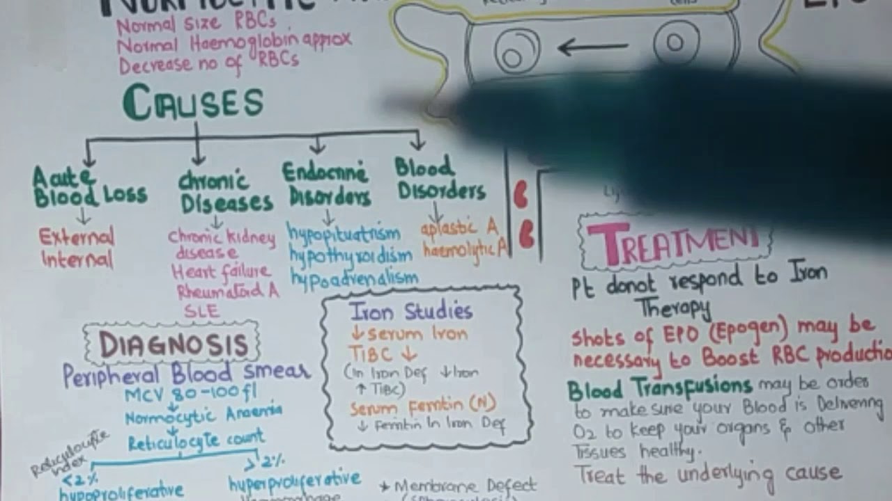 normocytic anemia | normocytic normochromic anemia - mnemonic ...