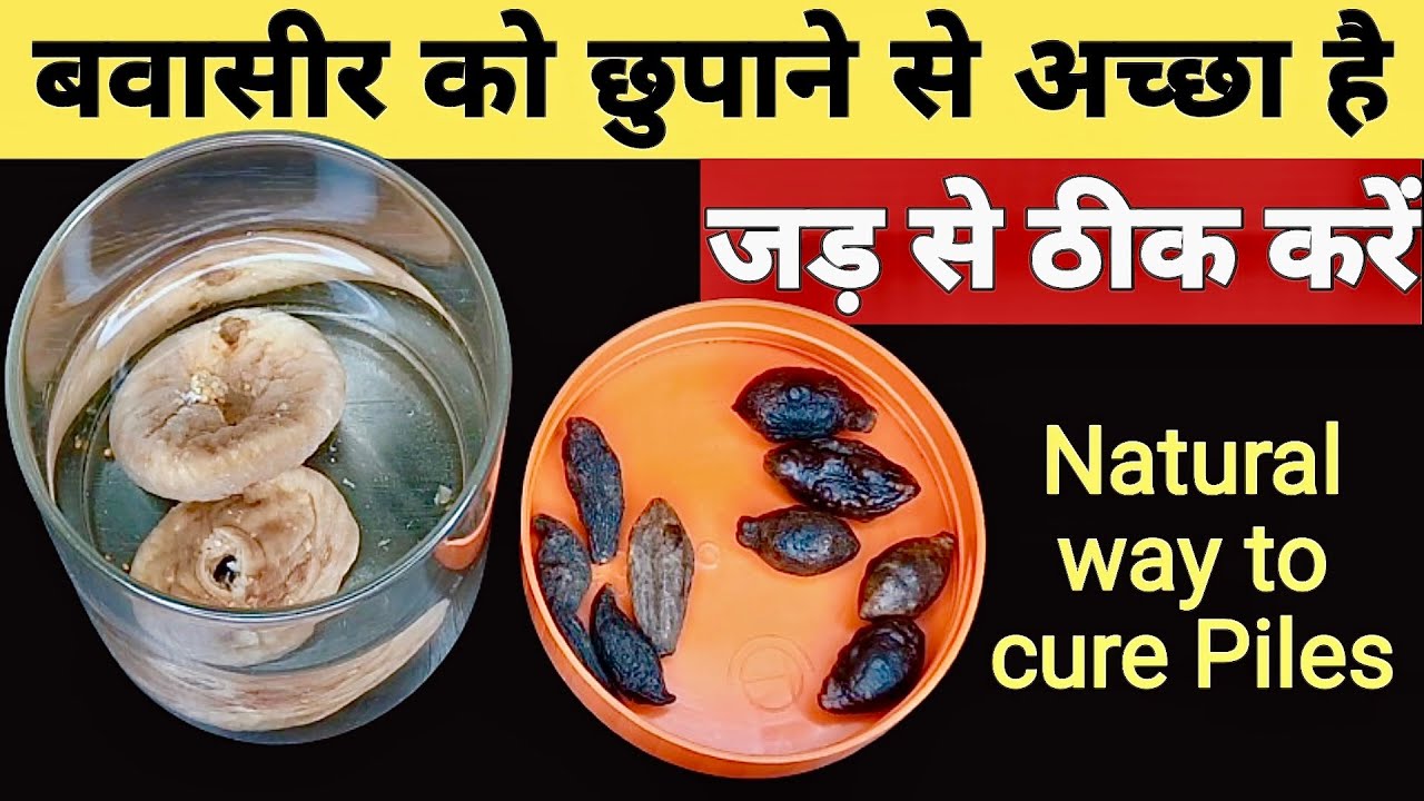 बवासीर को छुपाने से अच्छा ऐसे जड़ से ख़त्म करे | Natural way to cure ...