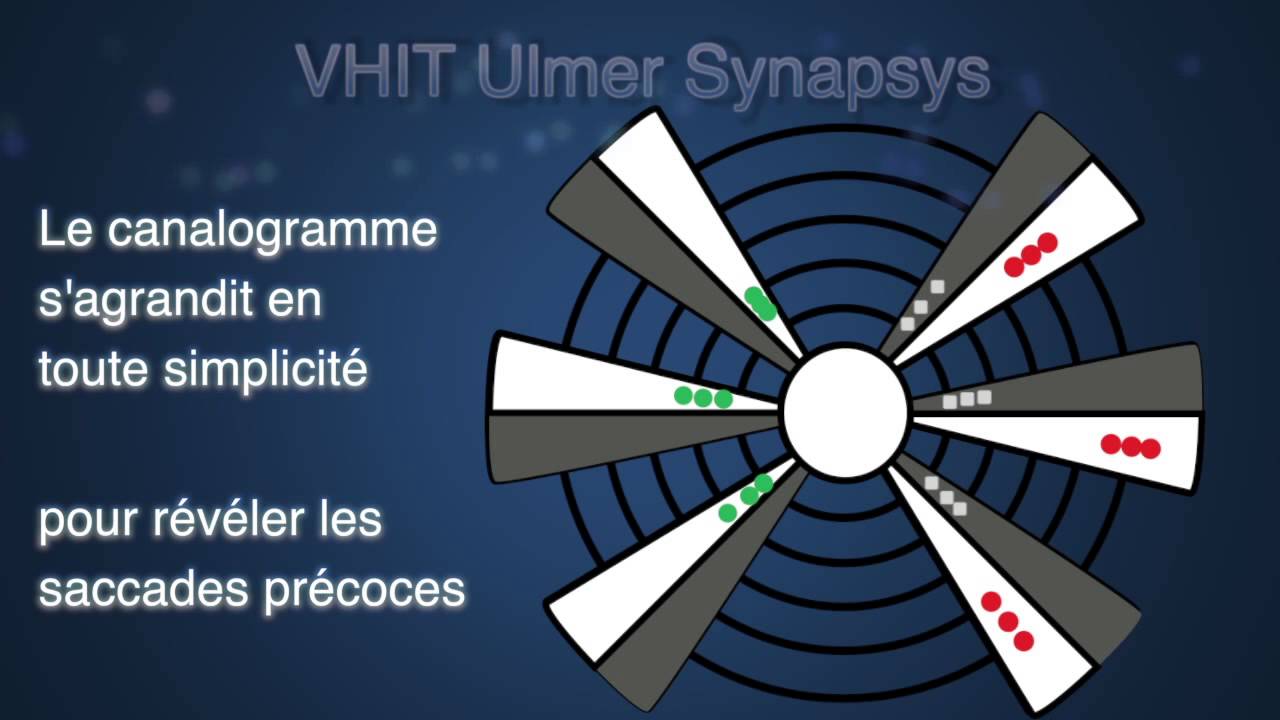 Nouvelle version VHIT Ulmer - YouTube