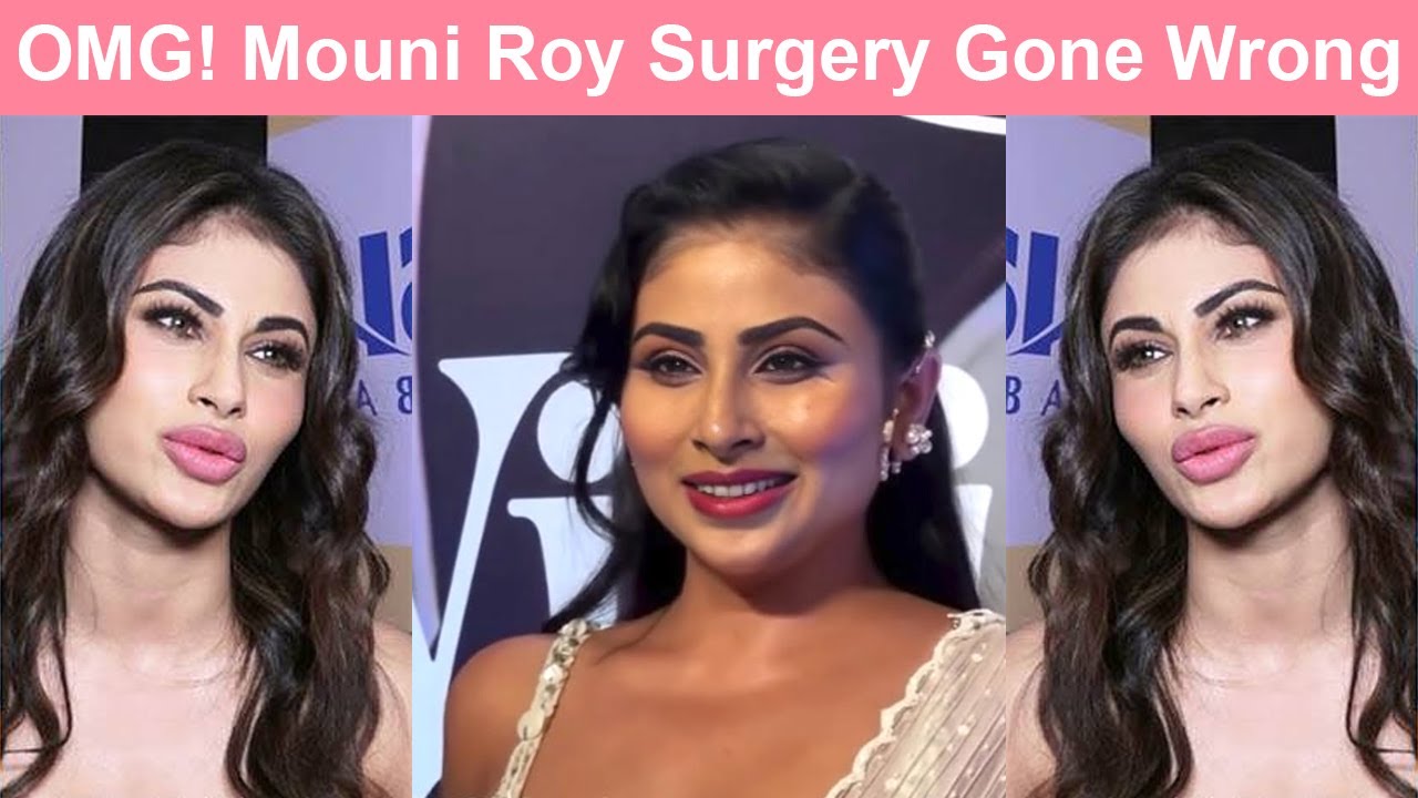 Mouni Roy Unrecognizable after Botox Surgery, Changed her Face & Even ...