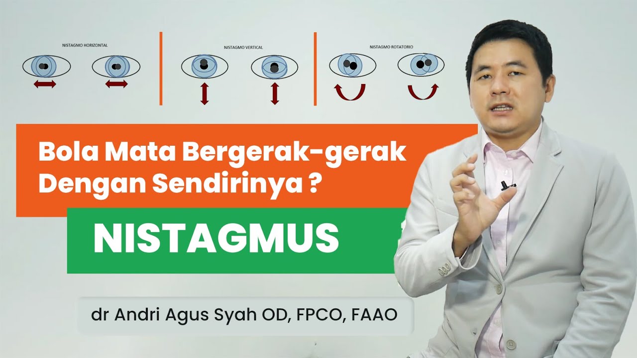 NISTAGMUS Mata Bergerak-Gerak Dan Susah Fokus - VIO Optical Clinic ...