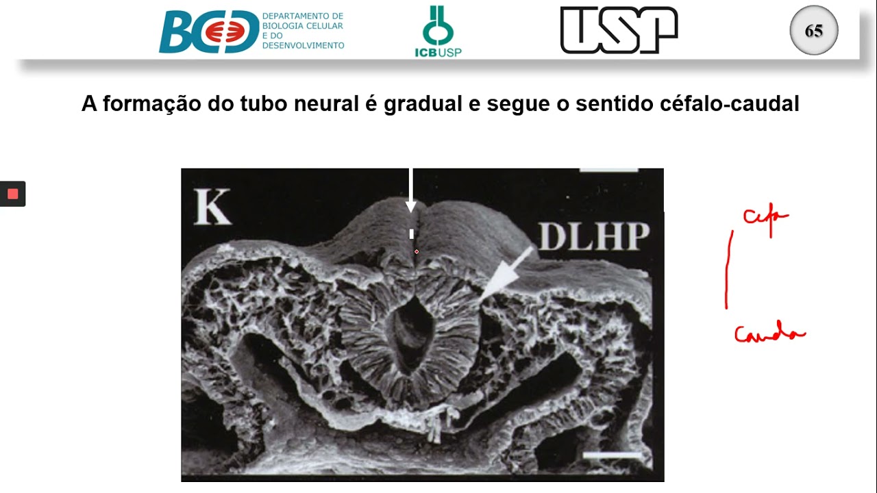 Aula de Embriologia Geral - Neurulação (Parte 3 de 4) - YouTube