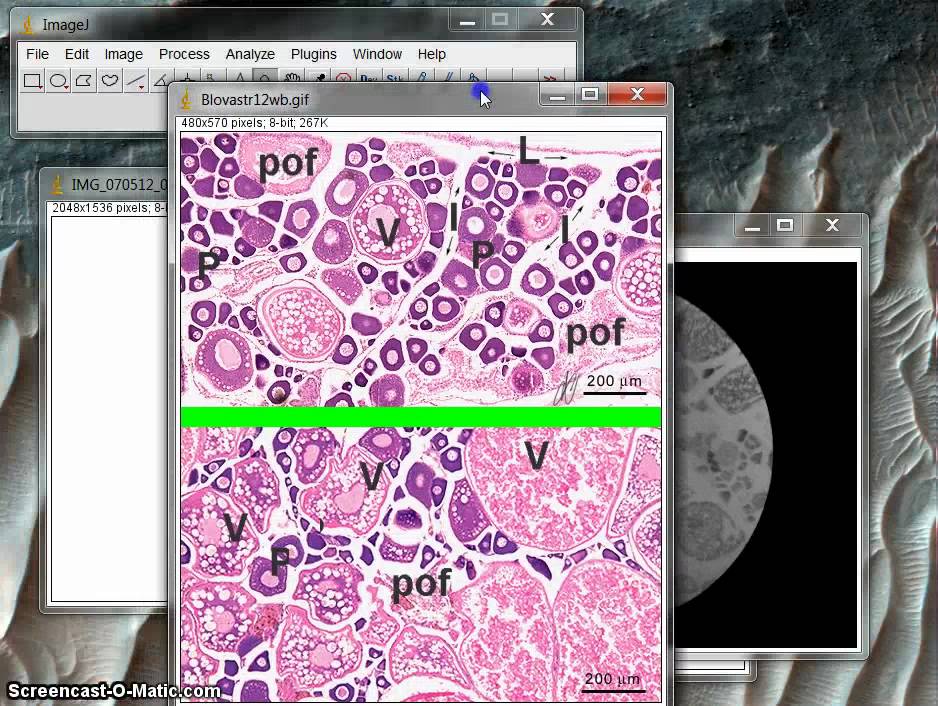 Counting oocytes on a cross-section of a fish ovary using ImageJ - YouTube