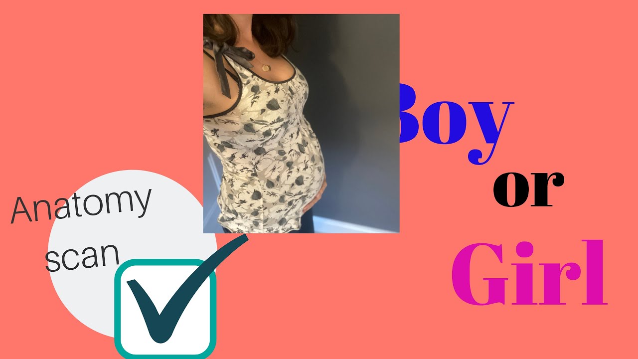 THE ANATOMY SCAN/ GENDER REVEAL - YouTube
