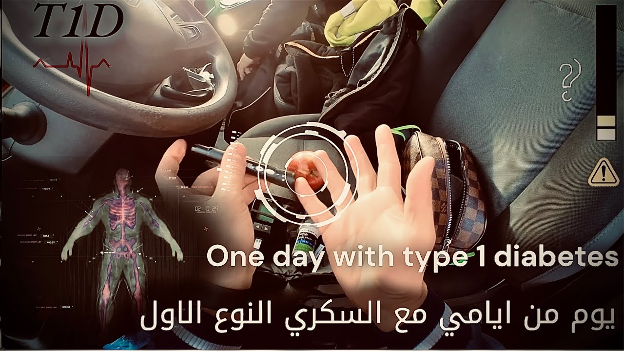 T1d | A Day in the Life of a Type 1 Diabetic - YouTube