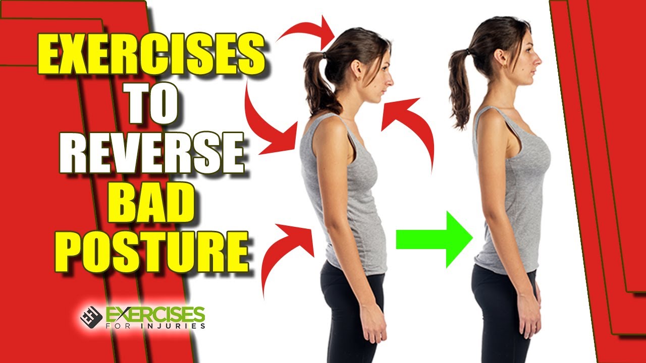 Exercises to Reverse Bad Posture │ Exercises For Injuries │ Posture ...