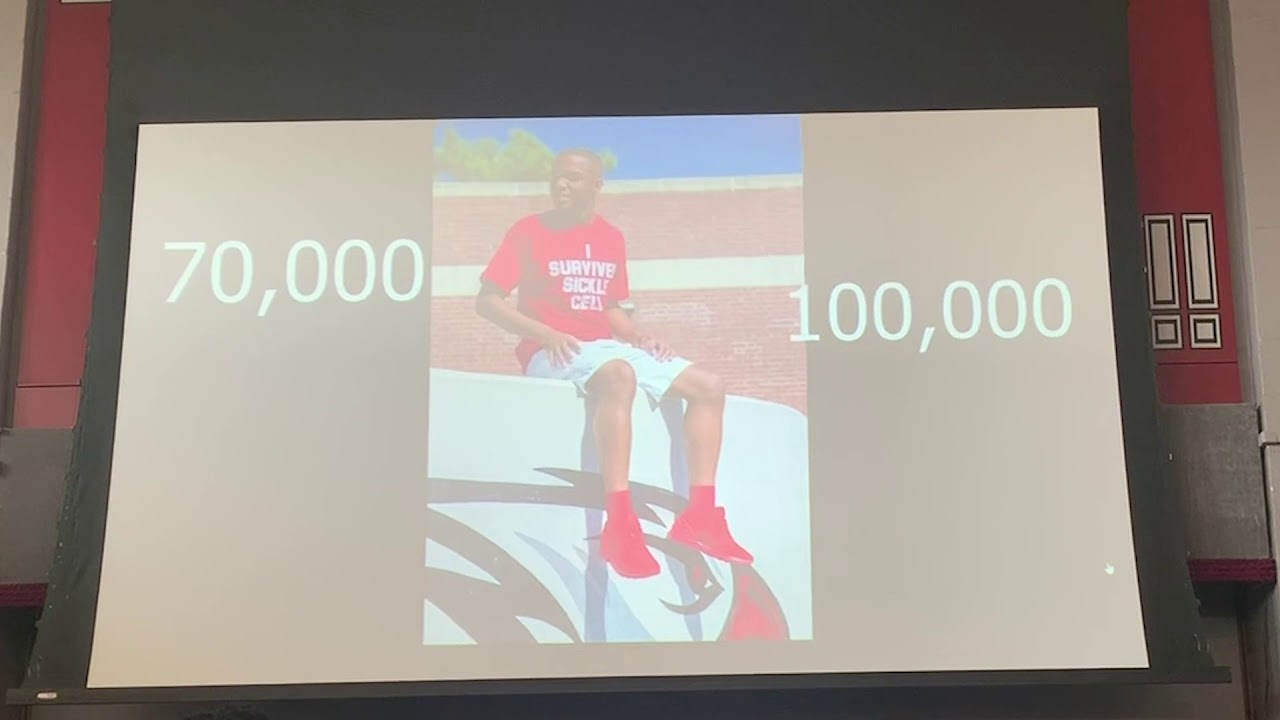 Chris Sickle Cell Story - YouTube