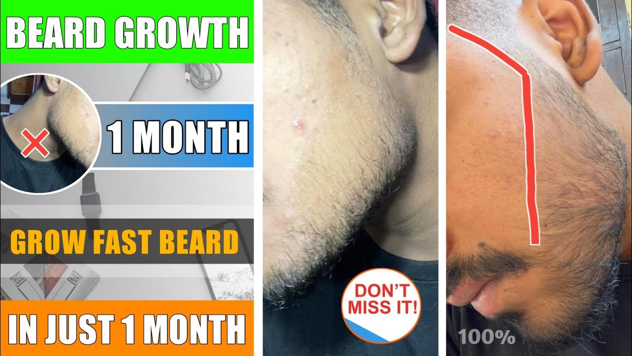How to grow full beard || Beard growth results before and after || Grow ...