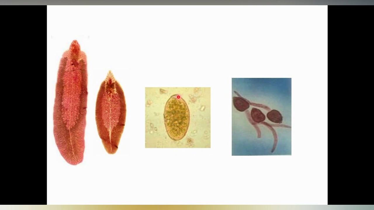 2- Trematodes Introduction and Fasciola - YouTube