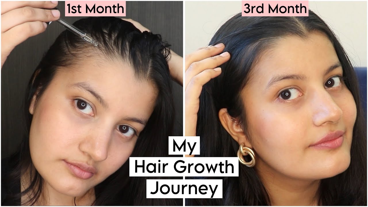 My 3 Months Experience of Using the Advanced Hair Growth serum - YouTube