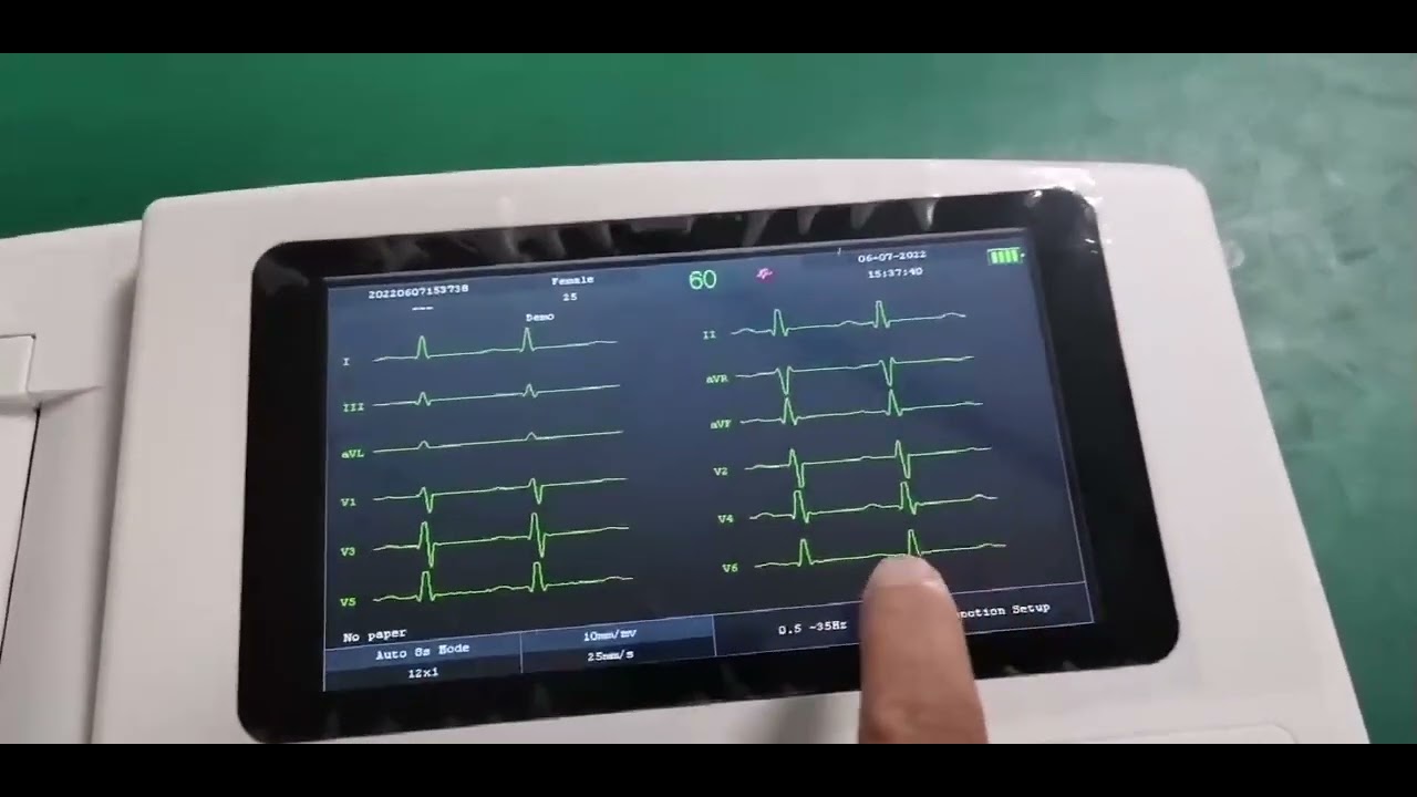 Digital Electrocardiograph ECG Machine COR-T12【Nanjing Archmed】 - YouTube