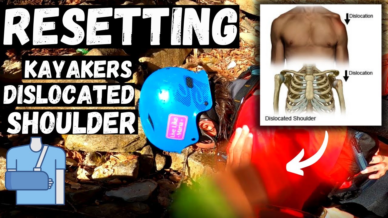 Dislocated Shoulder Reset "Cascades" - YouTube