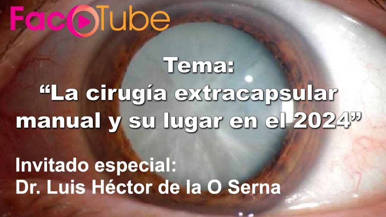 La cirugía extracapsular manual y su lugar en el 2024. - YouTube
