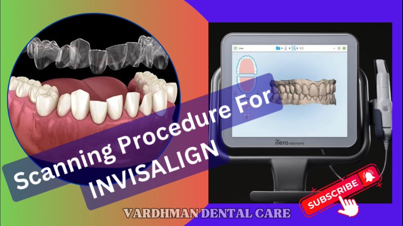 Scanning Of Teeth For Invisalign Treatment @vardhmandentalcare - YouTube