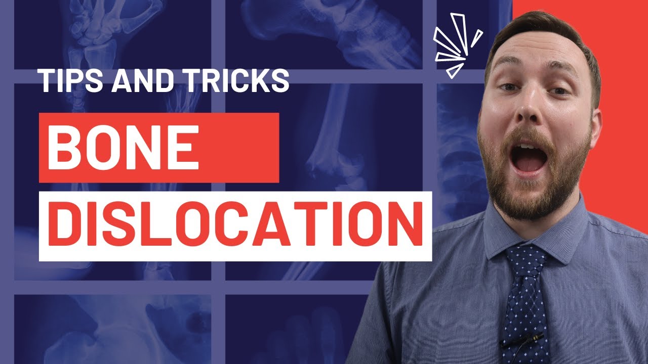 Bone Dislocation | What You Need To Know - Frederick Chiropractor - YouTube