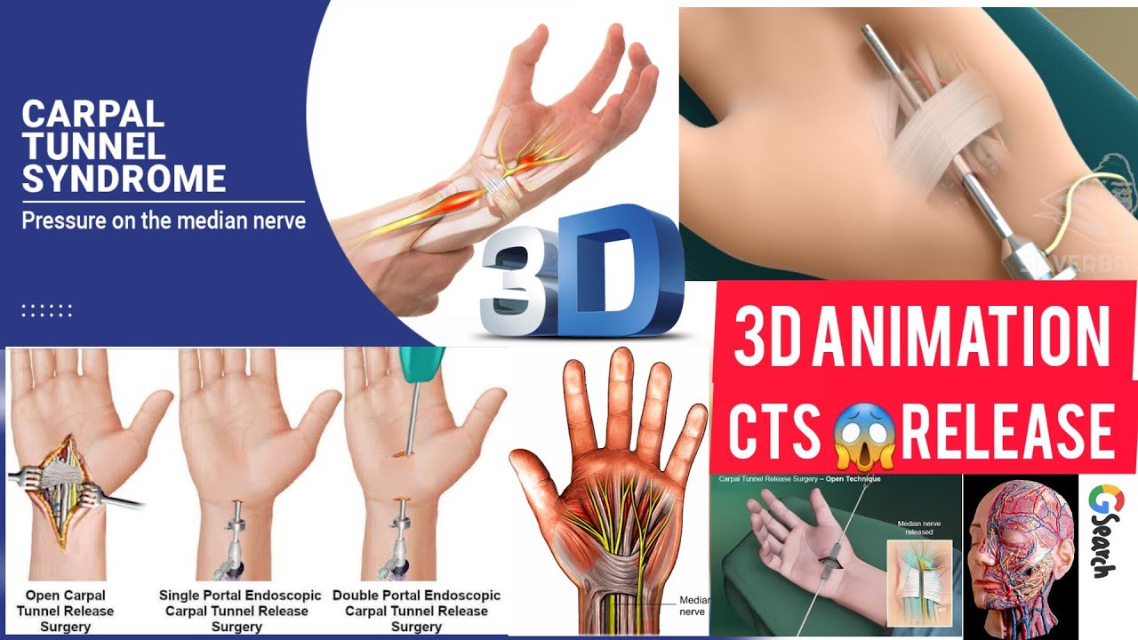 CTS RELEASE 😱3D ANIMATION VIDEO.#viral #anotomy#smartdoctor - YouTube