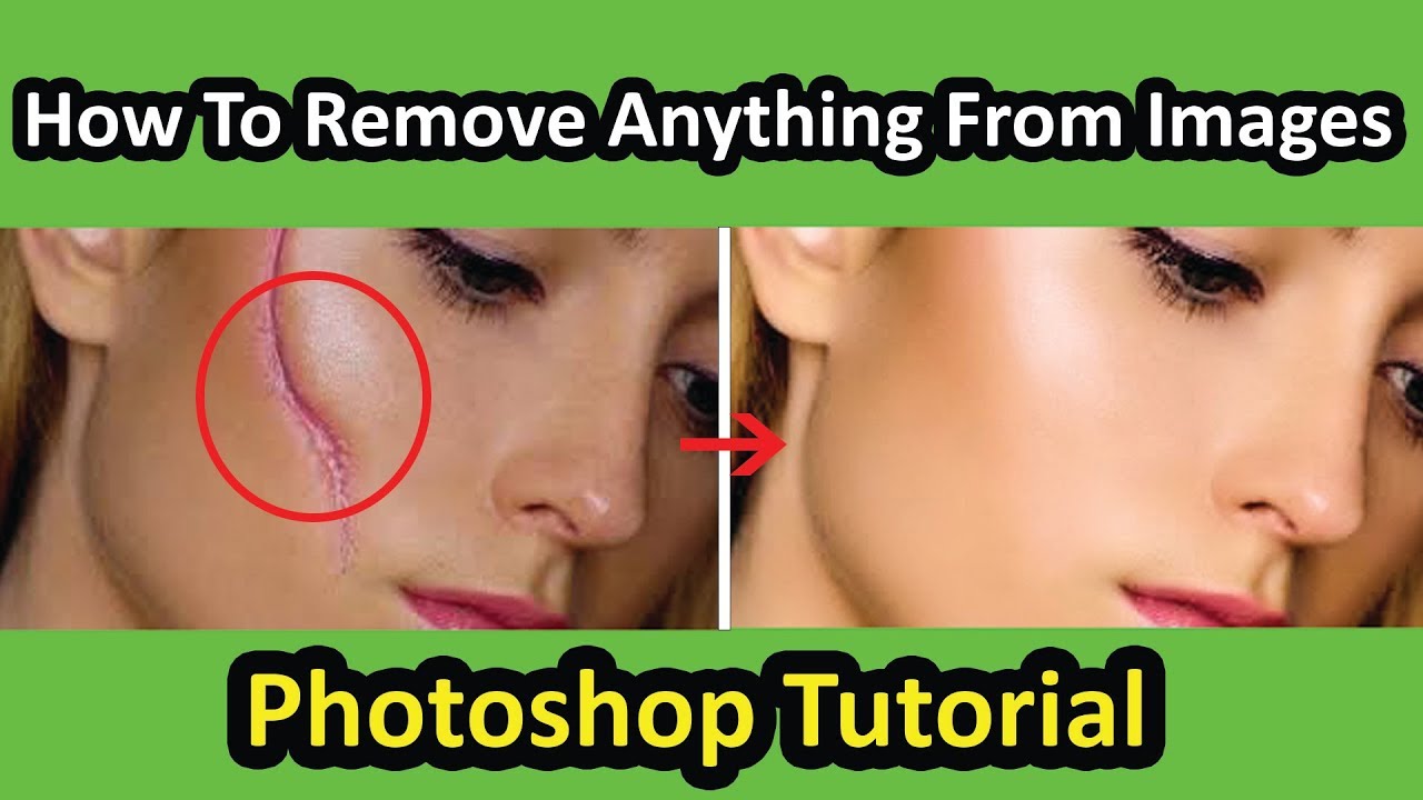 How To Remove Anything From Images Photoshop Tutorial YouTube how-to-remove-anything-from-images-photoshop-tutorial-youtube