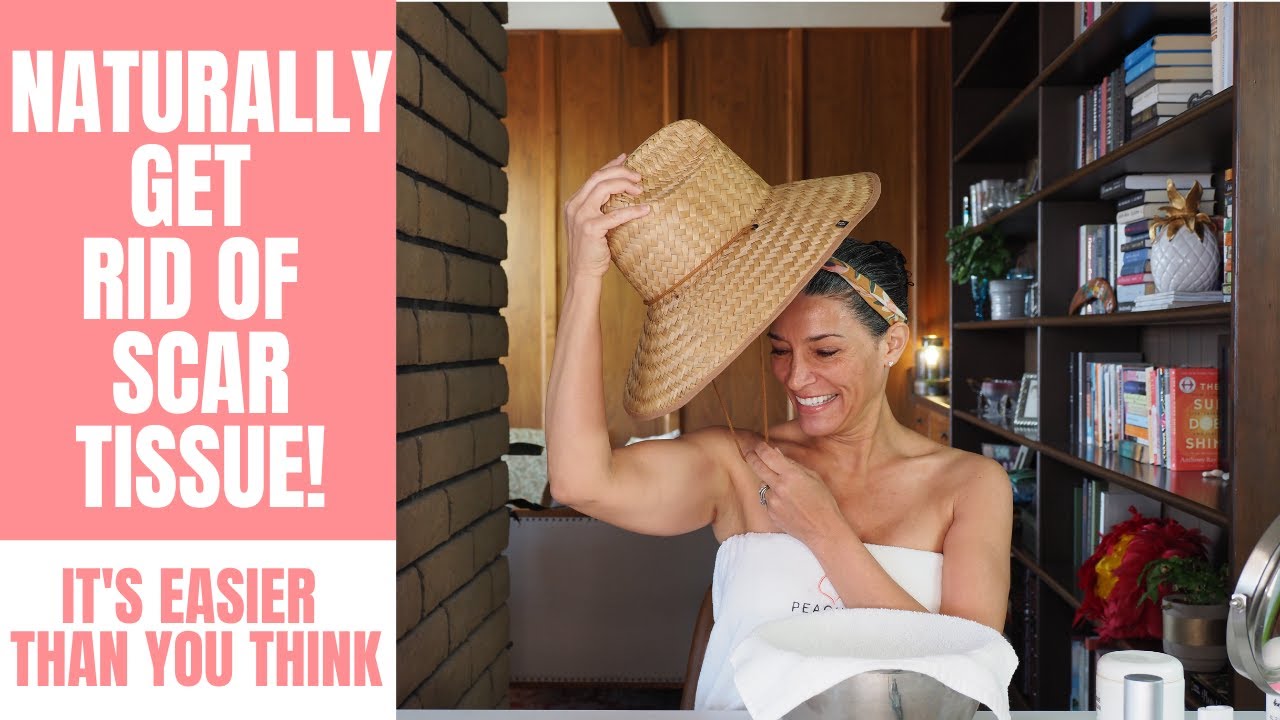 Get Rid of Scars, Dark Spots, & Melasma NATURALLY! | How to Reduce Scar ...