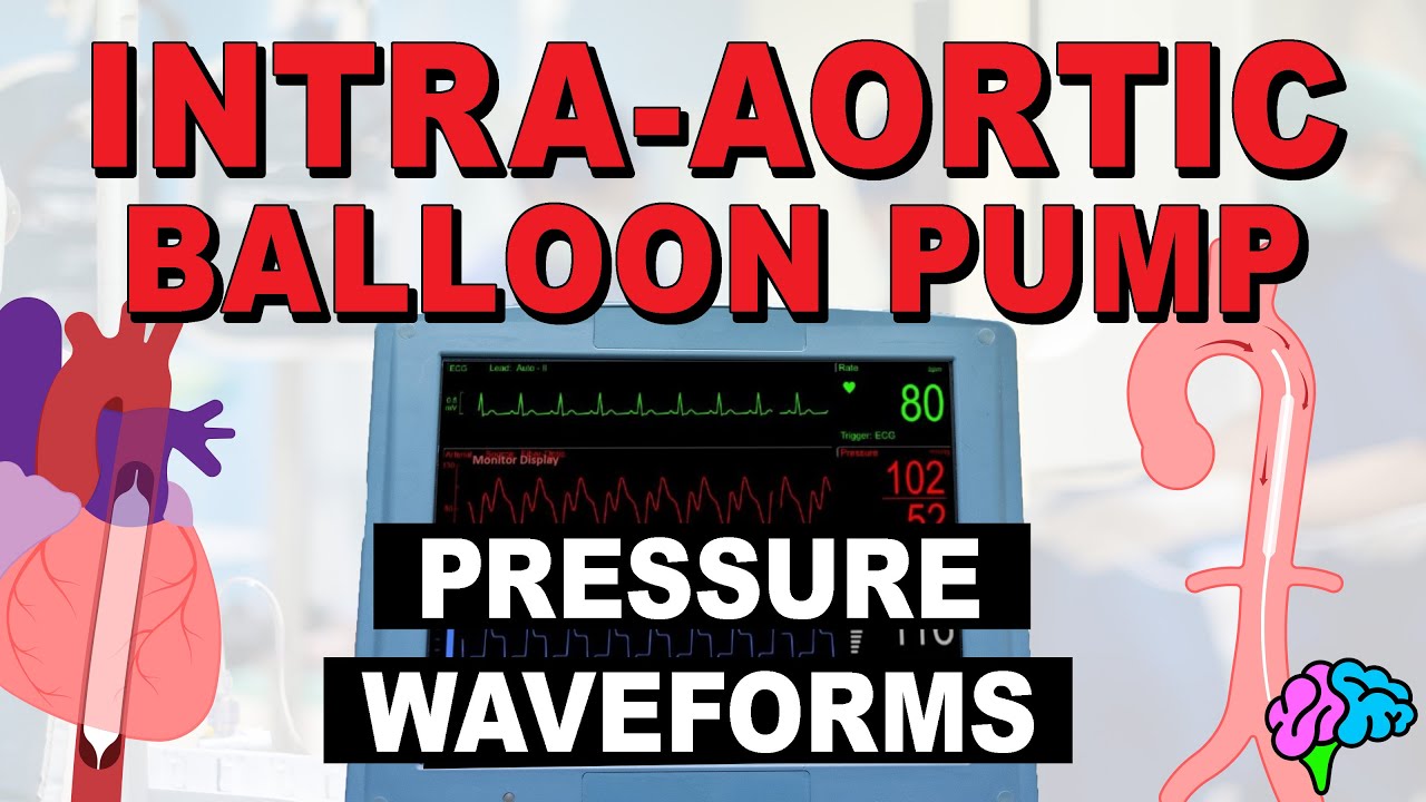 IABP Waveforms & Pressures EXPLAINED - YouTube