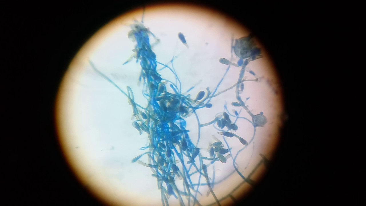 epidermophyton floccosum structure, under 45x compound microscope - YouTube