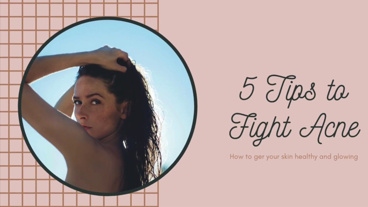 FIVE TIPS TO FIGHT ACNE! - YouTube