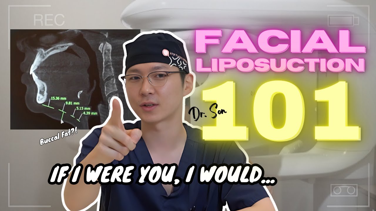 Buccal fat.. What’s that?! Plastic Surgeon Explains How To Achieve the ...