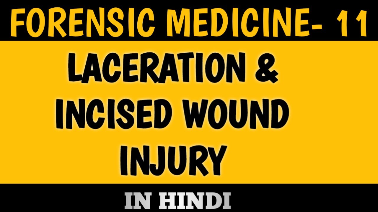 Laceration & Incised wound in forensic medicine | FMT chapter 11 part 4 ...
