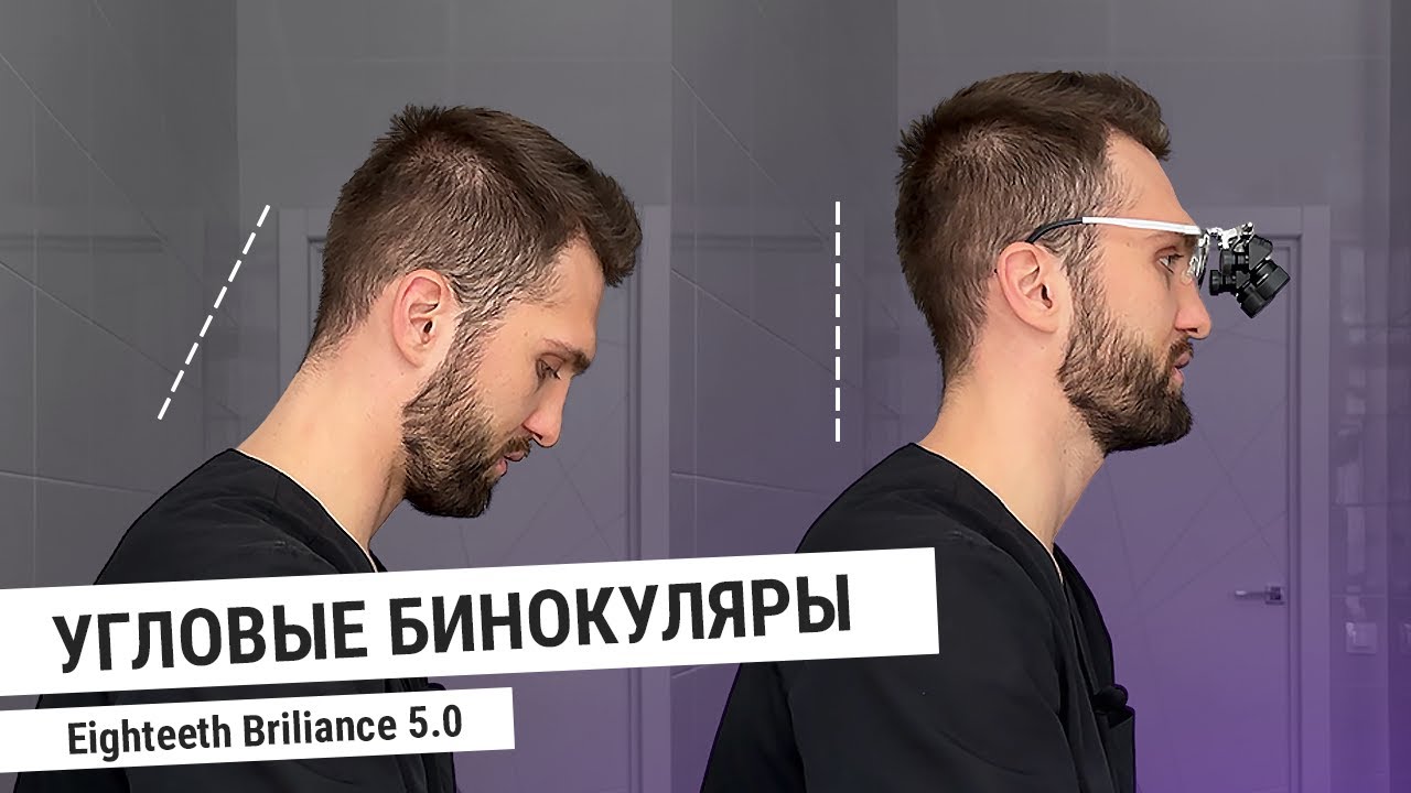 СтомОбзор №1 | Угловые бинокуляры Eighteeth Brilliance 48° - YouTube