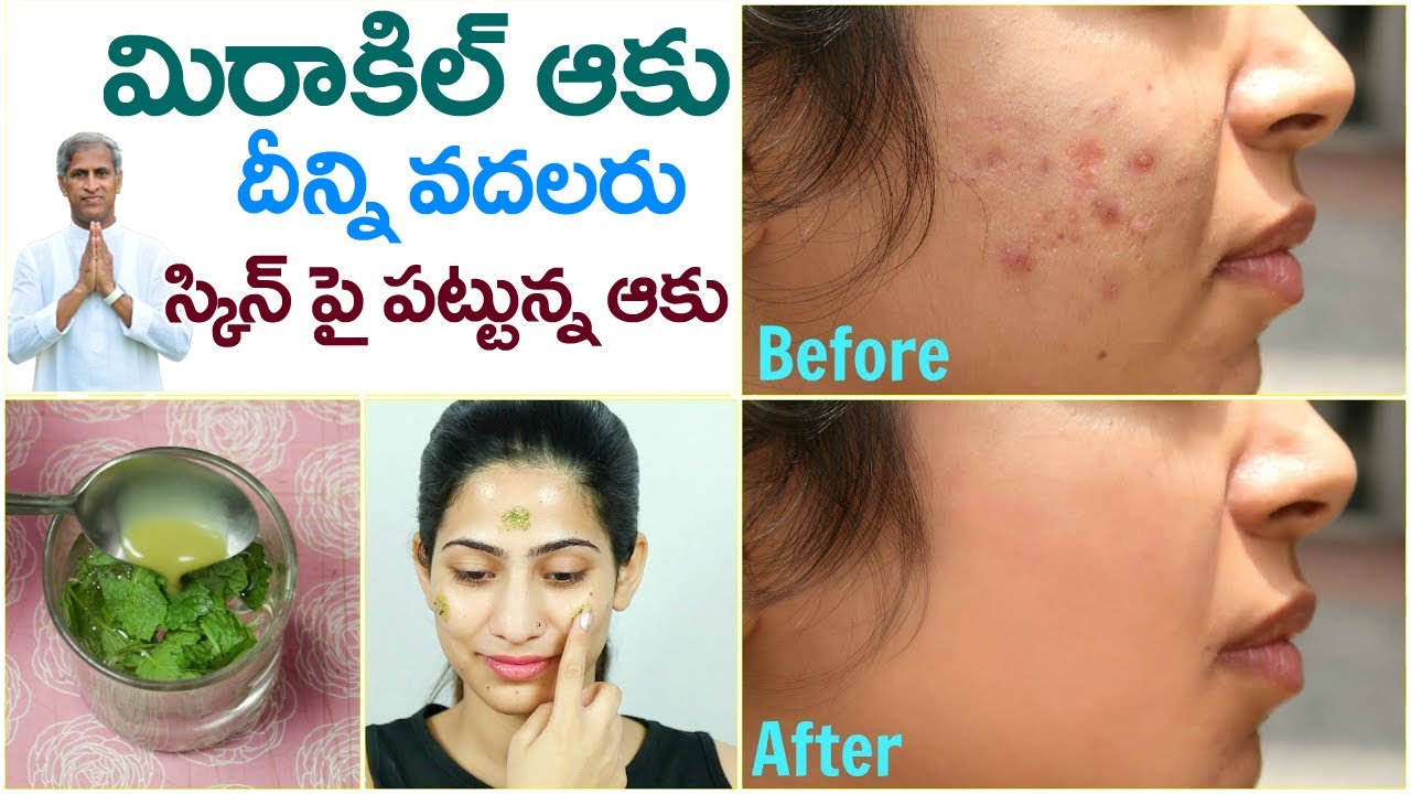 Miracle Leaf For Your Skin Glow | Coriander Benefits for Skin | Dr ...