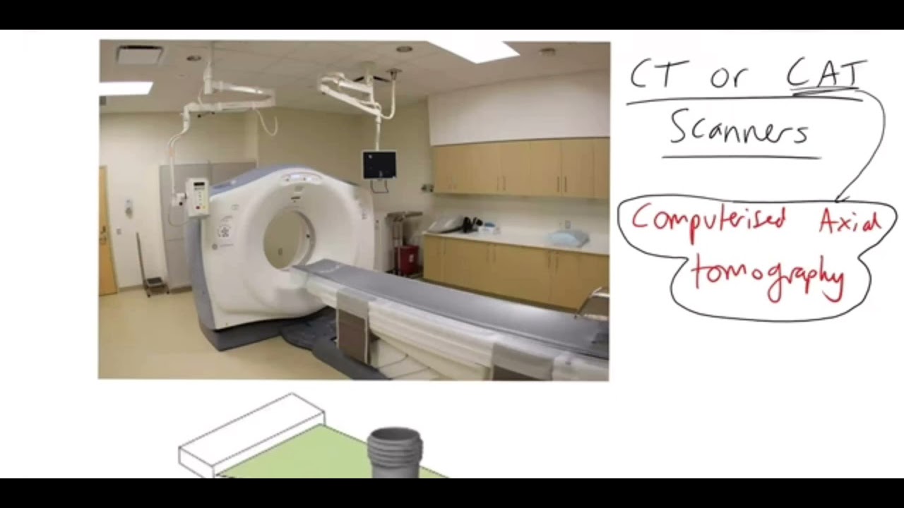Ct scans or cat scan - YouTube