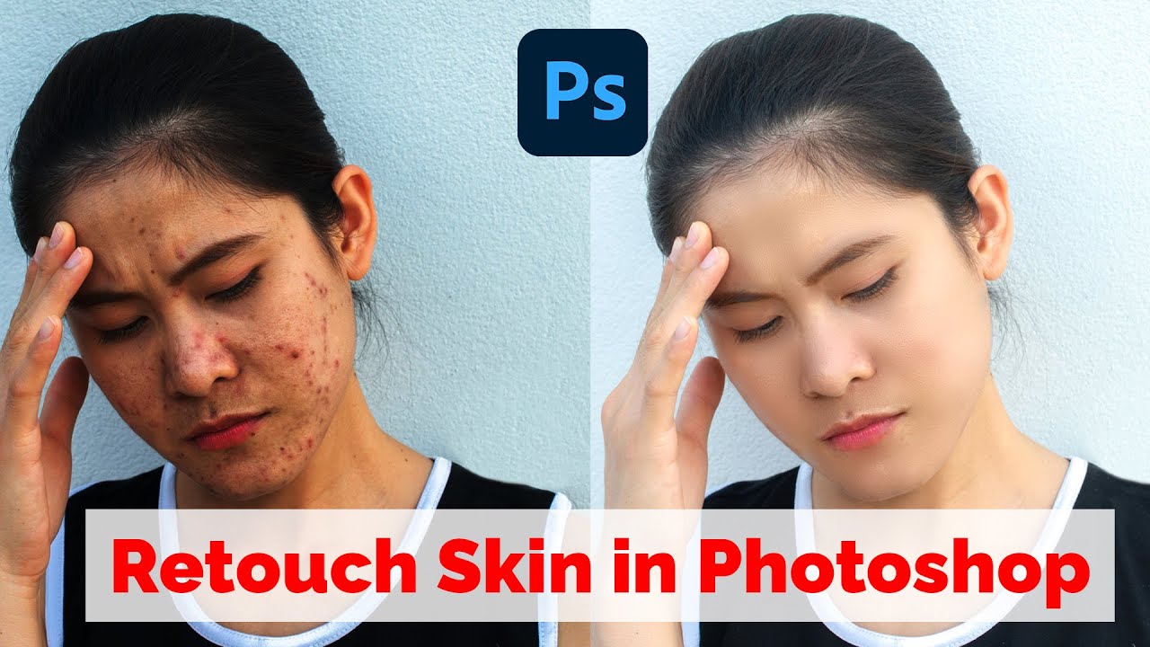 How to Retouch Skin in Photoshop | High End Retouching Technique ...