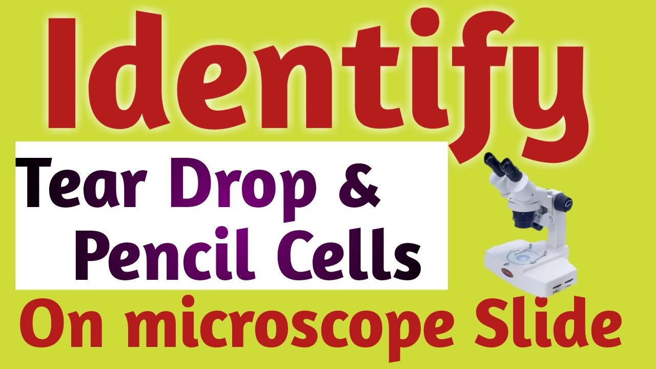 RBC morphology | Target cells in blood smear | Pencil cells on ...
