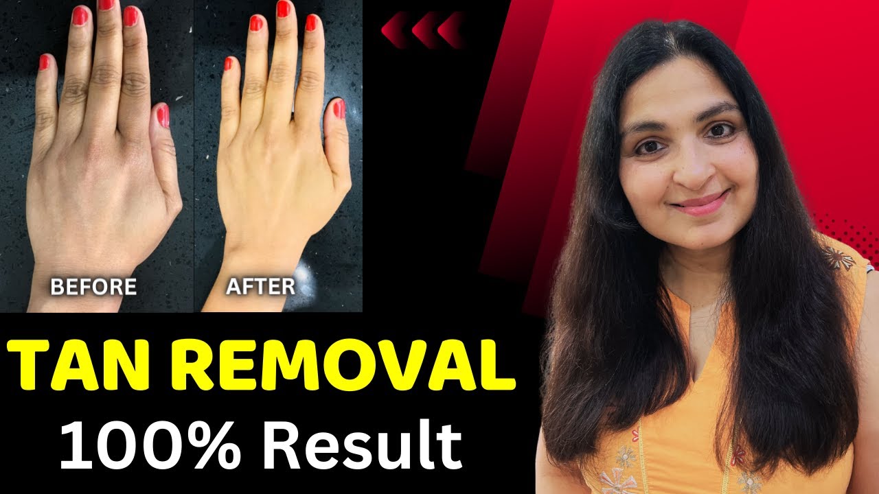 How To Remove Sun Tan 🌞 Instantly / Skin Brightening Face Pack ️ | # ...