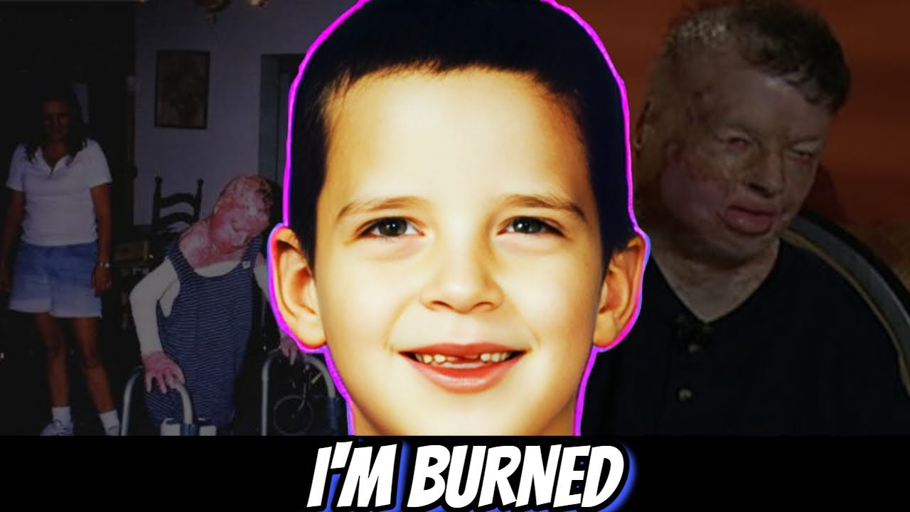 BURNED ALIVE to silence at 8 years old.Robbie Middleton.True Crime ...