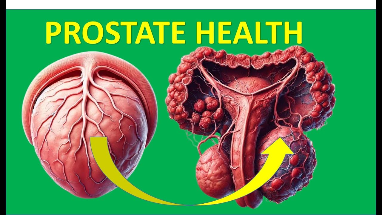 Prostate Health – What You Can Do - YouTube