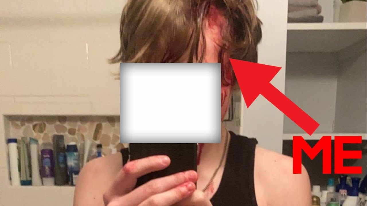 I Cracked My Head OPEN - YouTube