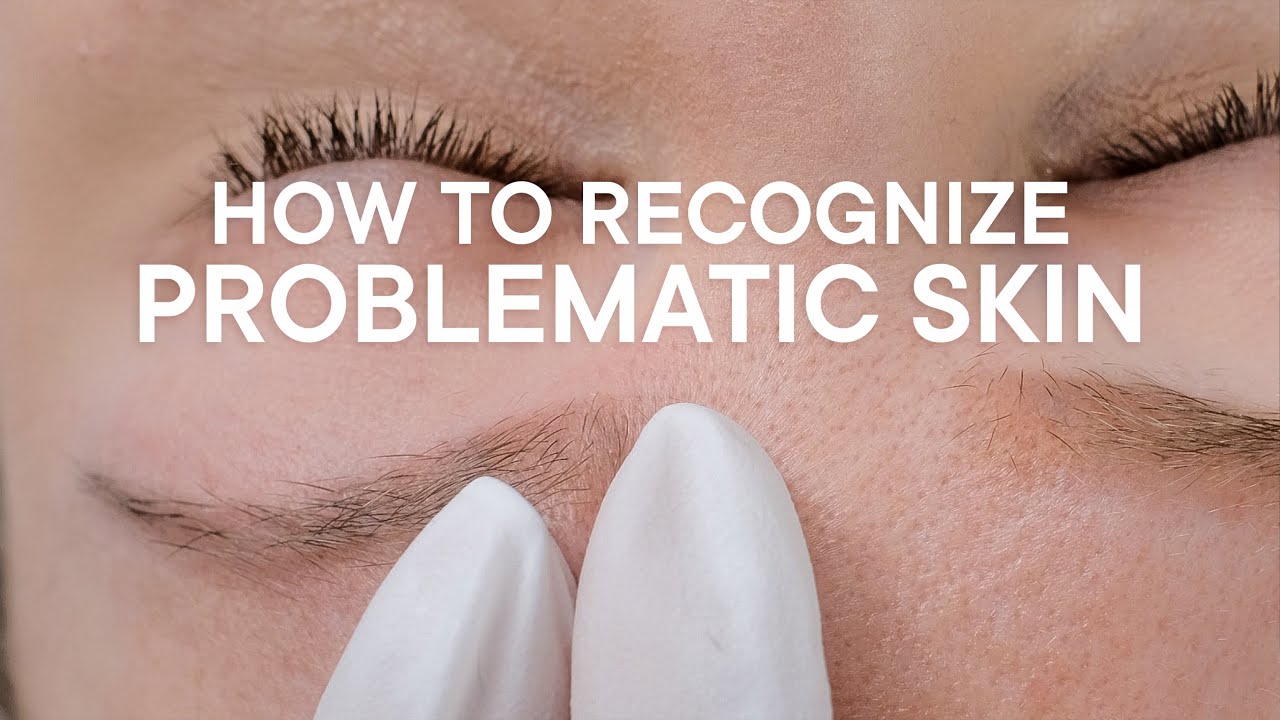 How To Recognize Problematic Skin - YouTube