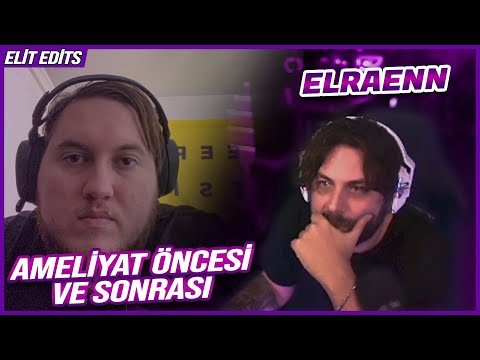 ELRAENN - RRAENEE'NİN AMELİYAT ÖNCESİ VE SONRASI DEĞİŞİMİNE BAKIYOR