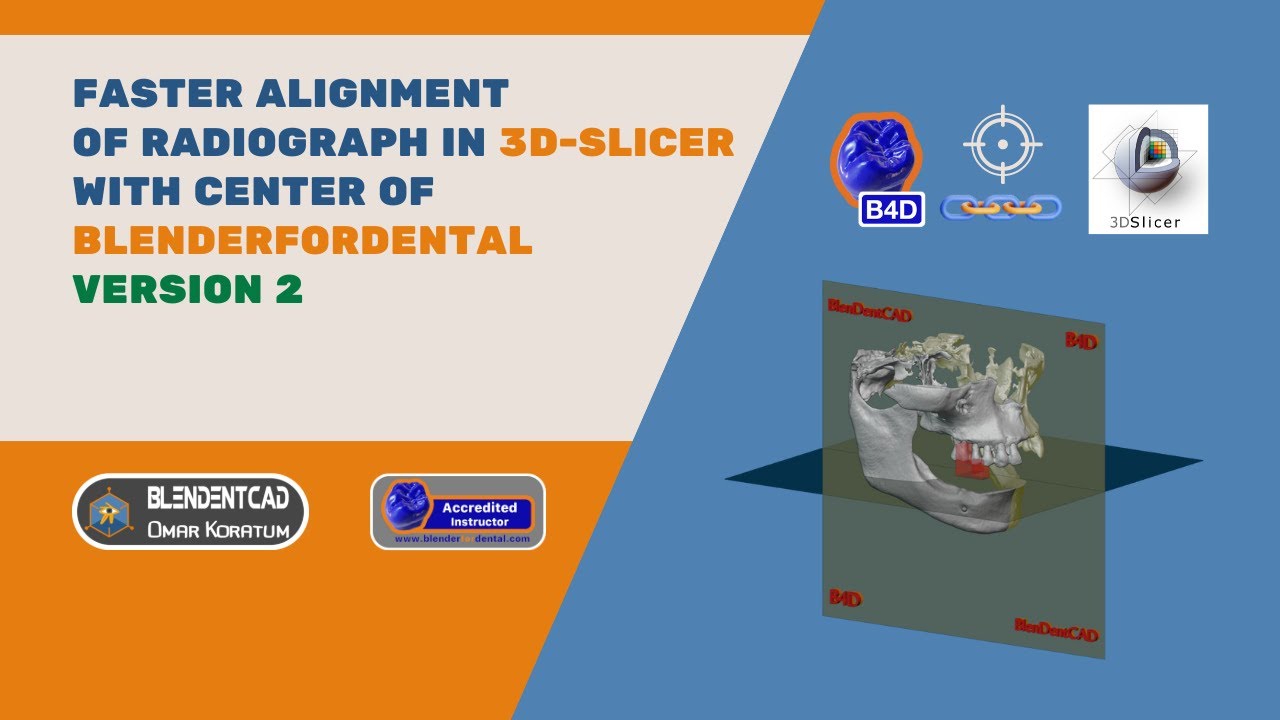 Faster 3D Slicer Segmentation alignment with Blenderfordental Center ...