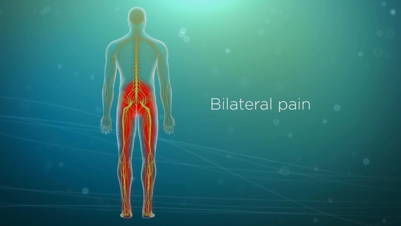 Pain Relief Starts with Coverage - YouTube