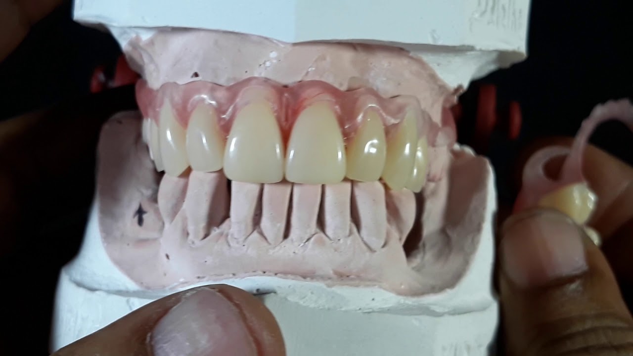 Flexite prótese estética flexível - YouTube