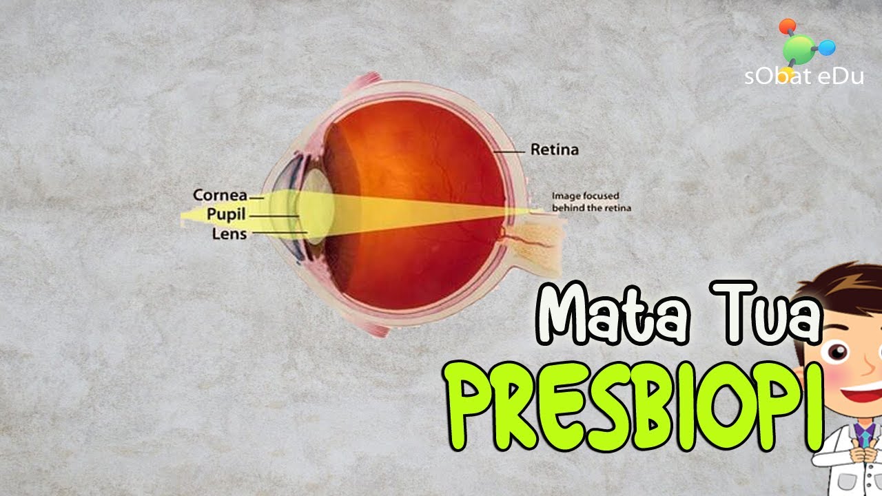 IPA FISIKA : Cacat Mata Presbiopi atau Mata Tua (Alat Optik) - YouTube