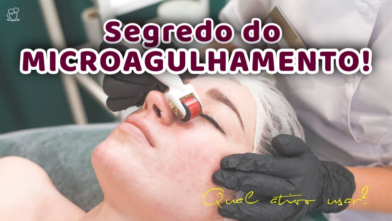 Qual ativo usar no MICROAGULHAMENTO para CICATRIZ de acne? - YouTube